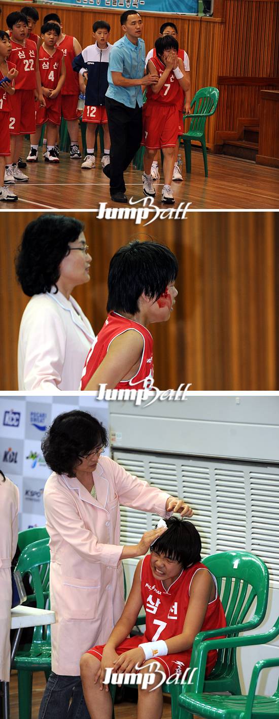 [2009 KBL총재배] 이인규 '아찔한 부상'