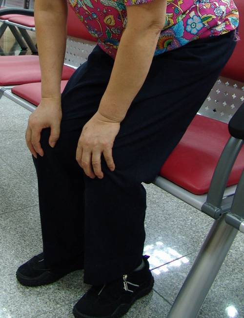 건강 무릎이 퉁퉁 부어오른다면