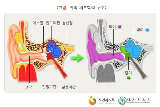 중이염 증상 감기인줄 알았는데 중이염이라고