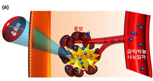 수술 없이 종양 제거 스마트 나노로봇 개발