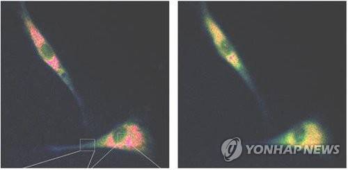 Kist·부산대 세포 속 칼슘농도 측정법 개발