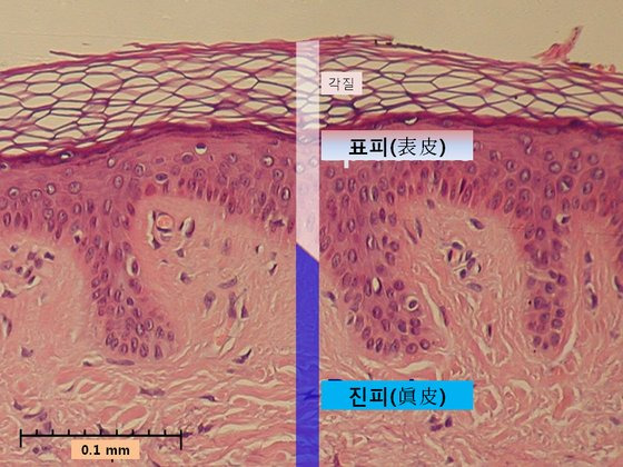 얼굴 세로주름에 깜짝 족발·돼지껍질 챙겨 먹어야 할까