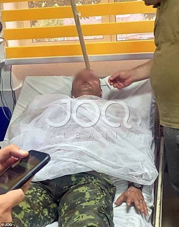 러시아 스파이들 알바니아 무기공장 침투 독액 스프레이 난사 월드pick
