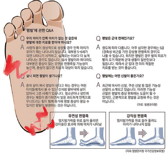 발 안쪽 아치 사라졌나요 굽 없는 신발 신지 마세요