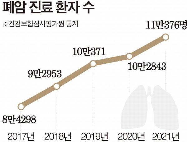 통증 없이 찾아오는 폐암 저선량 흉부ct 검진으로 조기 발견을