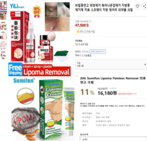 집에서 쥐젖 제거 식약처 허가받은 제품 없다