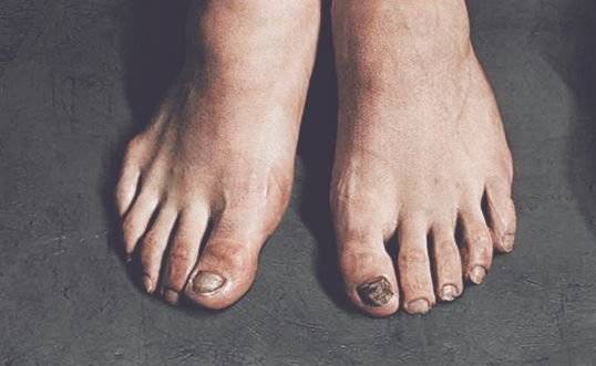 183㎝ 손흥민의 255㎜ 히든부츠