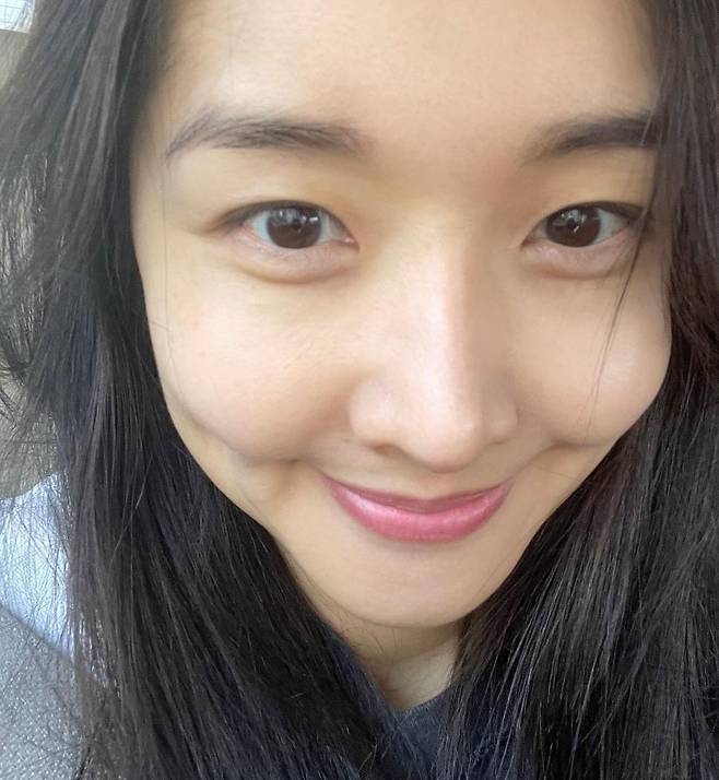 Kim Bin-woo "42 years old.. subeye fat relocation Eye correction