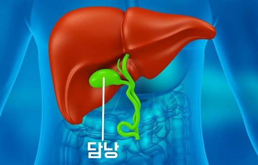 급체 소화불량 나타나는 담석증몸안에 돌 쌓이는 병