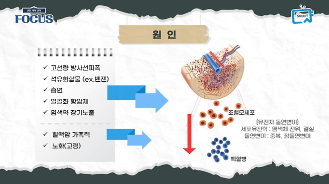 한눈에 이해하는 급성골수성백혈병 서울대학교병원