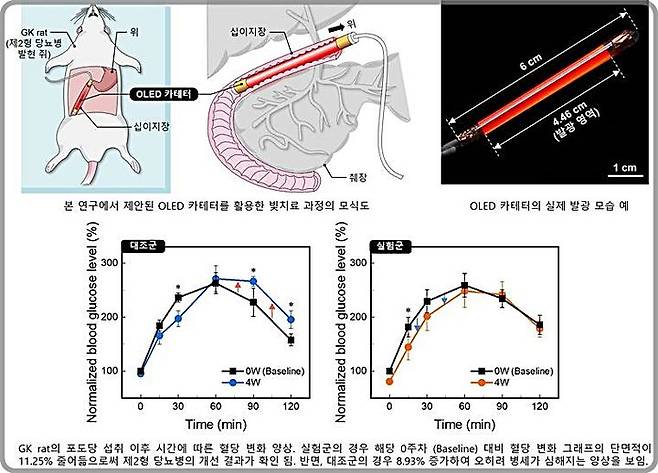 국내연구진 체내 Oled 빛치료 구현빛으로 장기 치료