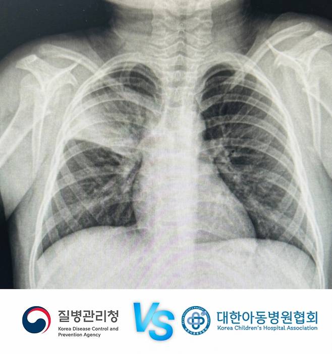 이 폐렴 걸린 아이들 급증에도질병청 데이터에 아동병원 빠진 이유