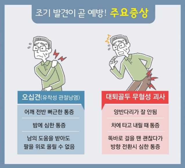 이런 증상 나타나면뼈 죽는 대퇴골두 무혈성 괴사 의심