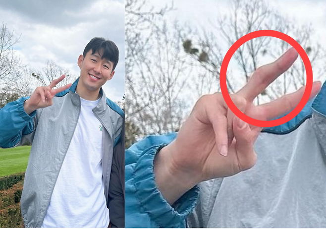 얼마나 아팠을까”테이핑 푼 손흥민 손가락 보니 ‘충격