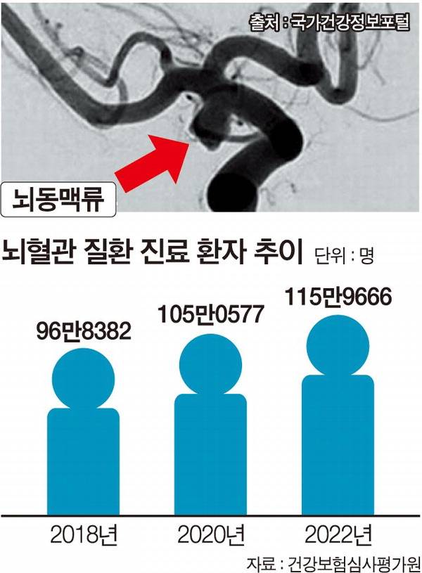 갑자기 찾아오는 뇌동맥류 두통 잦다면 꼭 영상검사를