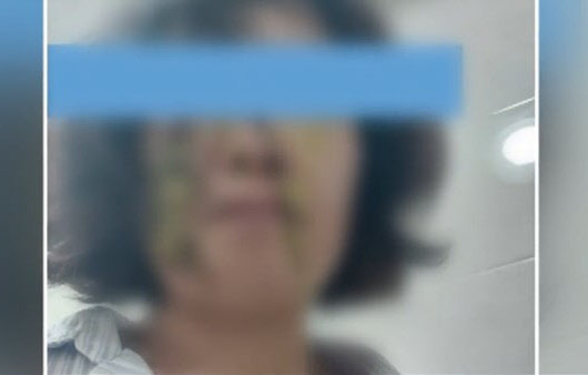 대화하려고 왔는데”女교사 얼굴에 ‘똥기저귀 싸대기 날린 엄마