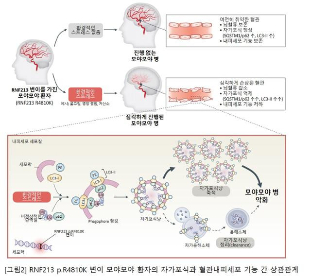 아지랑이처럼 뇌혈관 피어오르는 모야모야병 악화 원인 찾아내