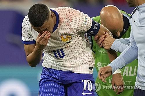 속보 코뼈 부러진 음바페 마스크 추천해달라수술 No→잔여 경기 출전 의지 유로 2024