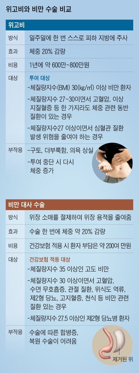 내게 맞는 체중 감량 치료법은위고비·비만 수술 비교해보니