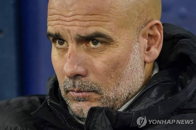 얼굴 상처 과르디올라 감독 자해 발언 사과경솔한 대답