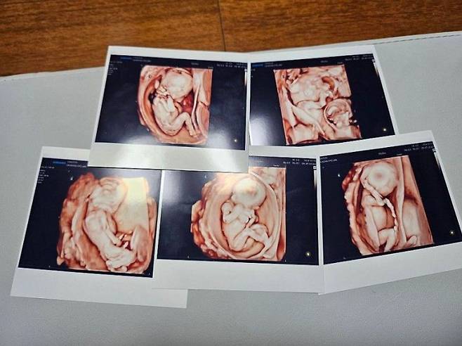 이젠 걱정보다 행복자연 임신 오둥이네가 전한 근황