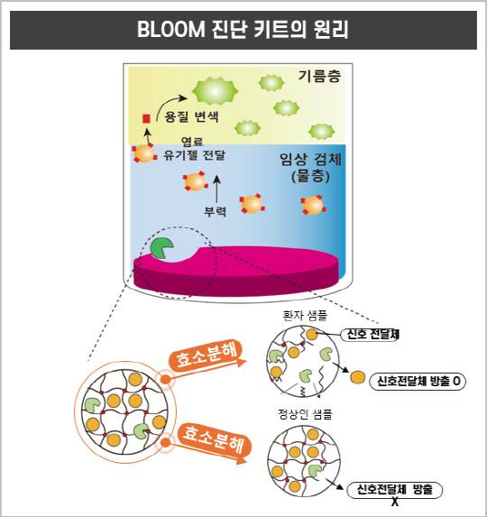 재발률 70 방광암 소변으로 정확히 진단초기 방광암까지 진단