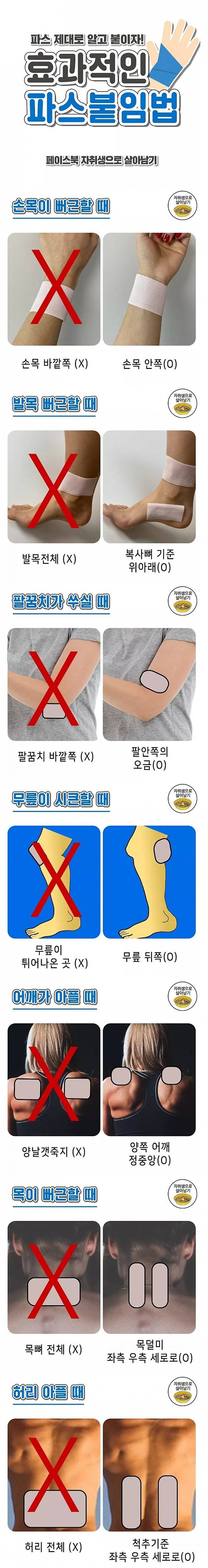 제대로 파스 붙이는 방법 에펨코리아