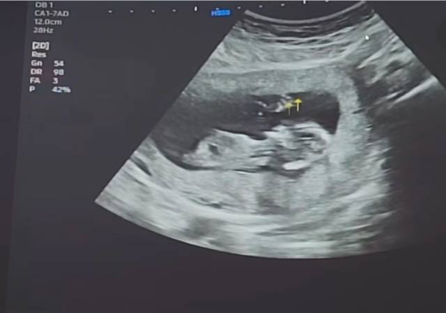 이진아 결혼 6년만 임신 발표 신비한 하루백아연→비와이 축하 물결
