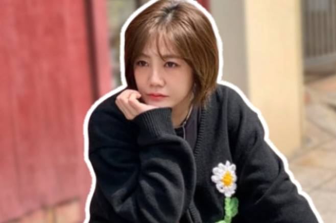 내 코 어떡해 빙판길 넘어진 여배우 멍 투성이 된 얼굴 충격 근황 나남뉴스