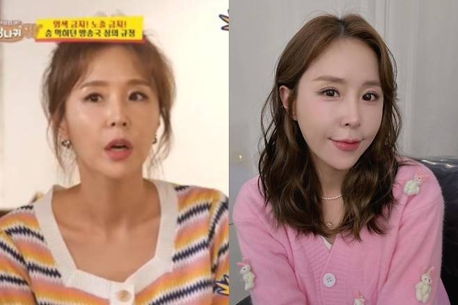 신지, 티 나니까 밝힌다 “눈 리모델링”